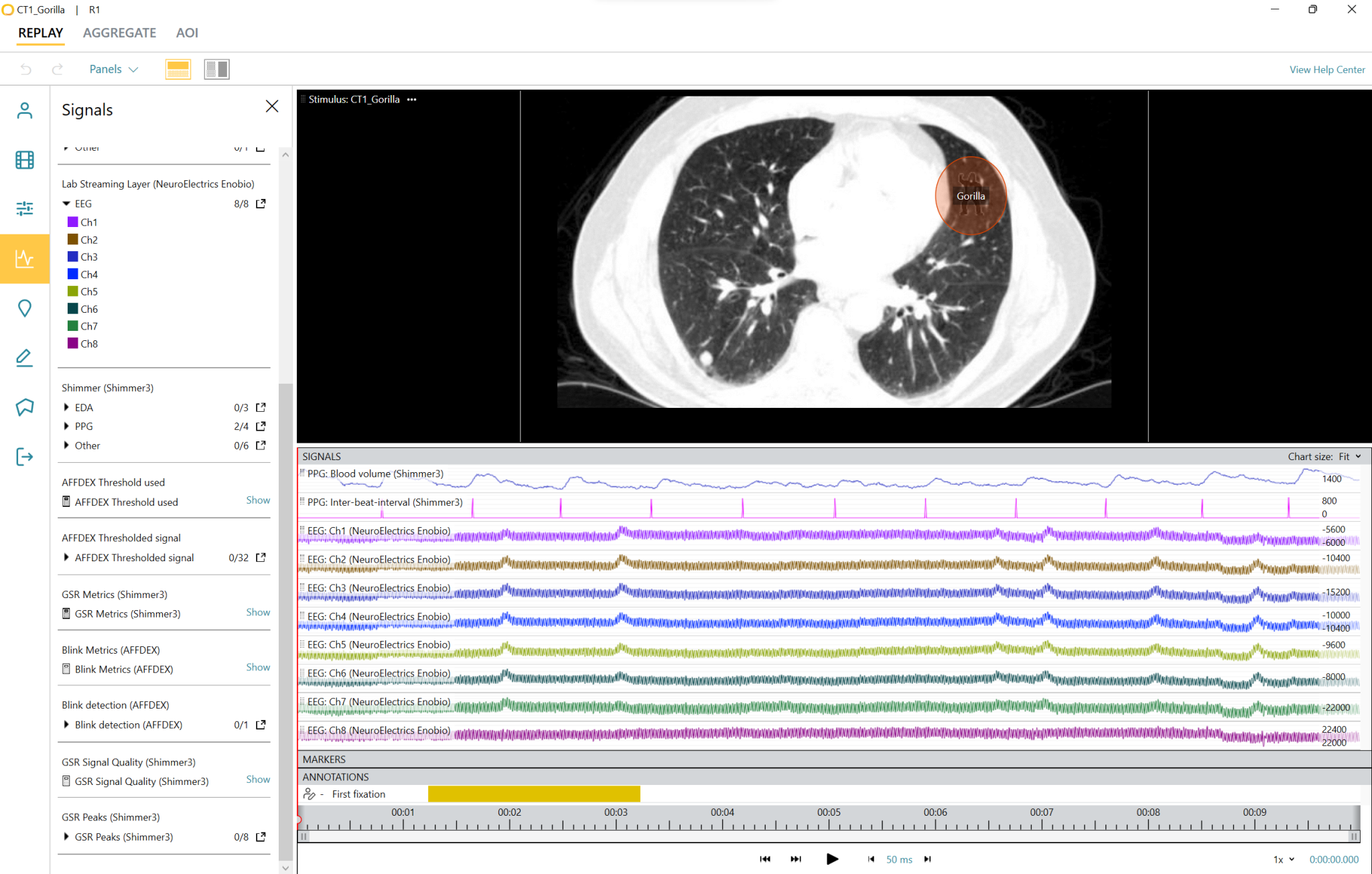Electroencephalography (EEG) Software - iMotions